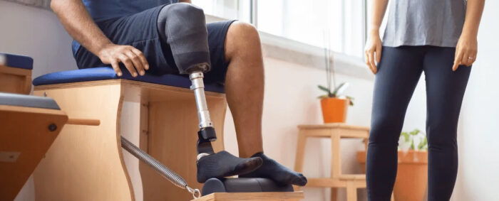Prosthetic Interface Materials – Ideal Artificial Limbs Solution