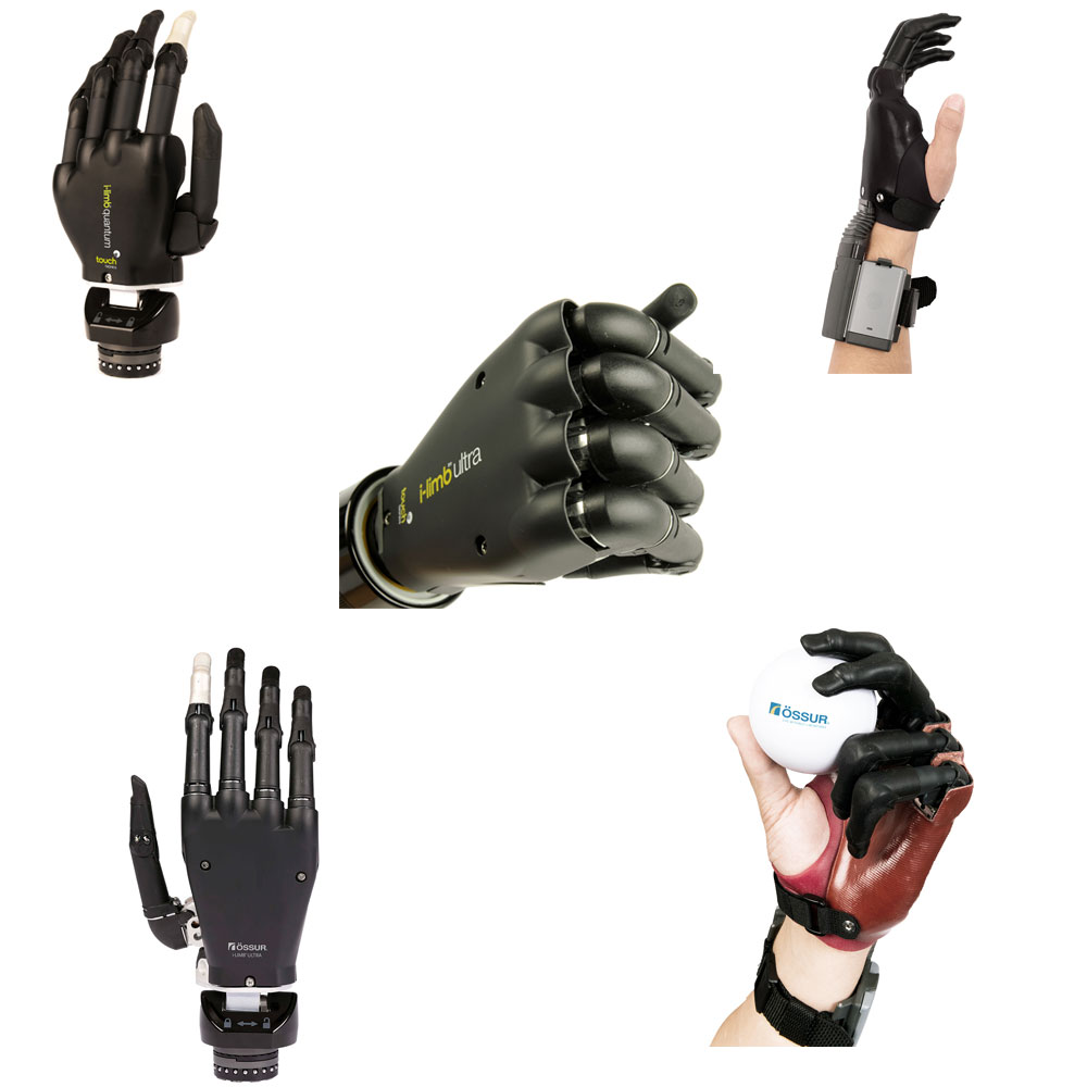 i-Limb™ Upper Limb Prosthetic – Bionics – Ideal Artificial Limbs Solution